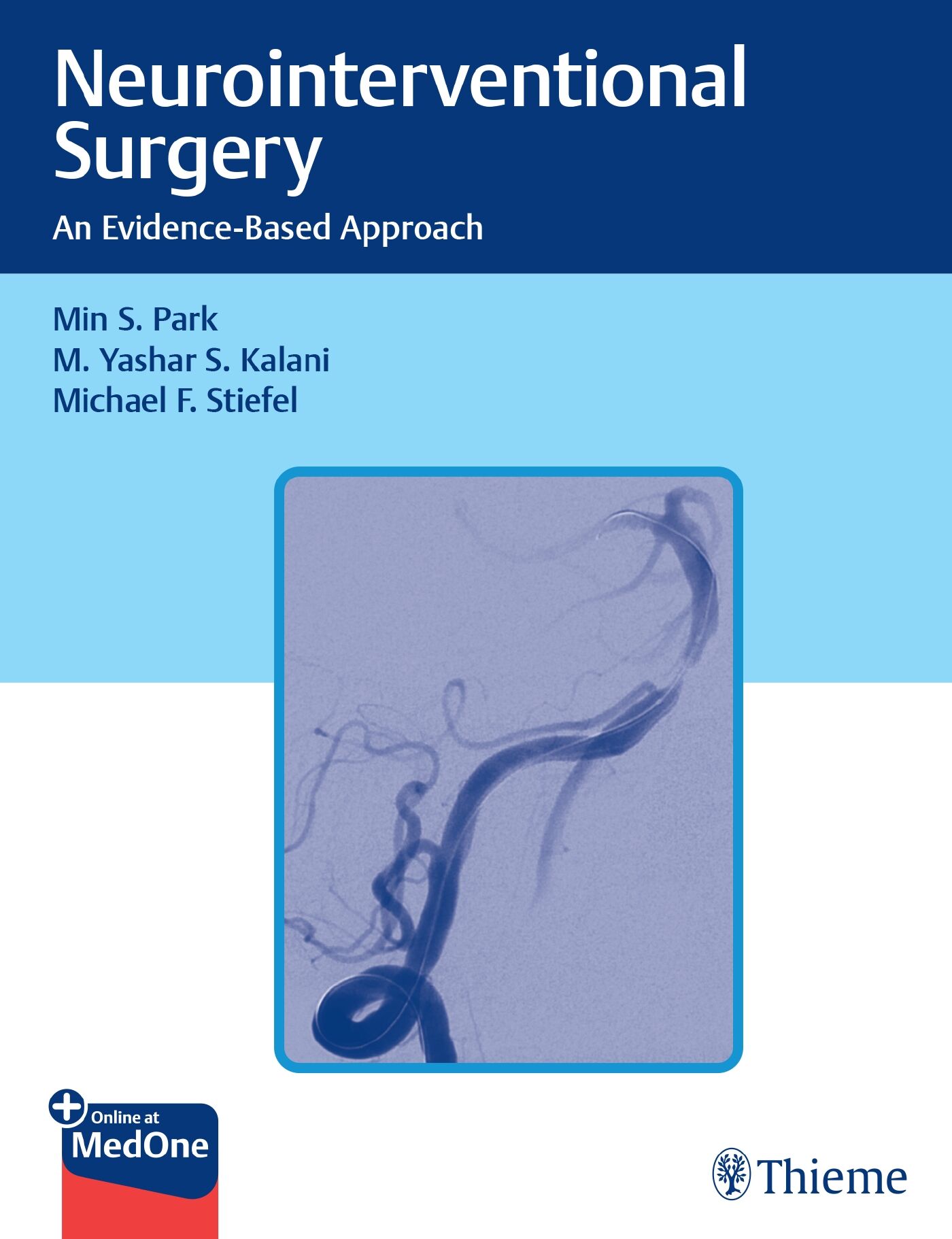 Neurointerventional Surgery: jetzt bestellen im Thieme Webshop ...
