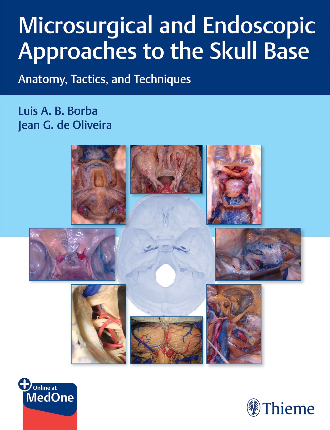 Microsurgical and Endoscopic Approaches to the Skull Base | 9781626239708 | Thieme Webshop