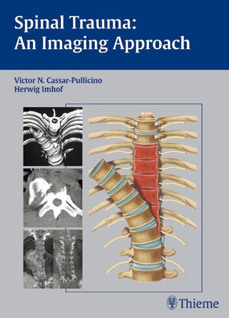 Spinal Trauma - An Imaging Approach | 9783132578388 | Thieme Webshop