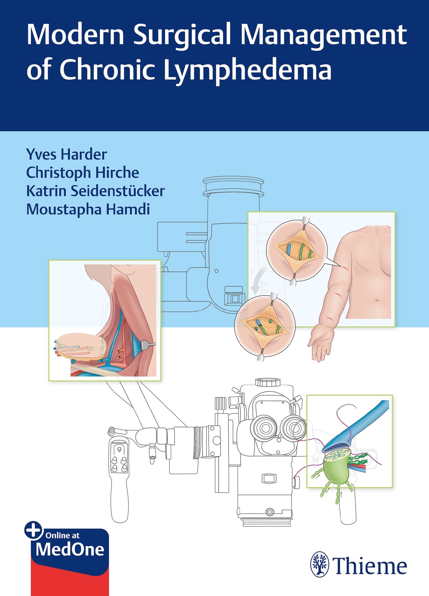 Modern Surgical Management of Chronic Lymphedema | 9783132582385 | Thieme Webshop