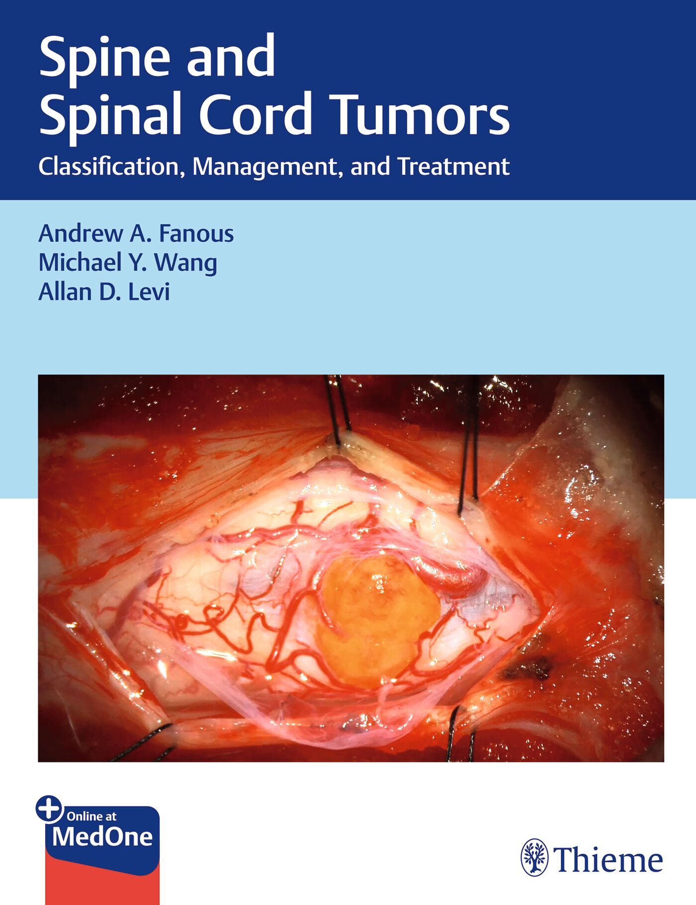Spine and Spinal Cord Tumors | 9781638536826 | Thieme Webshop