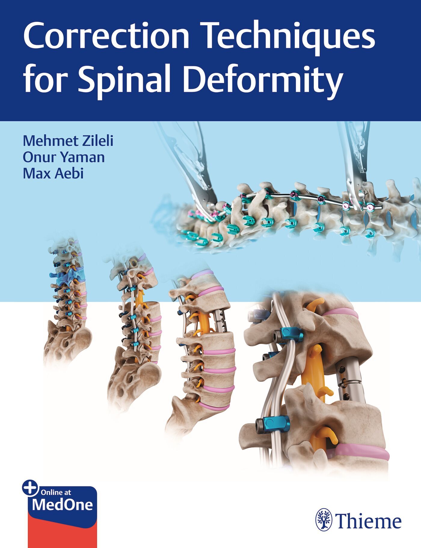 Correction Techniques for Spinal Deformity: jetzt bestellen im Thieme ...
