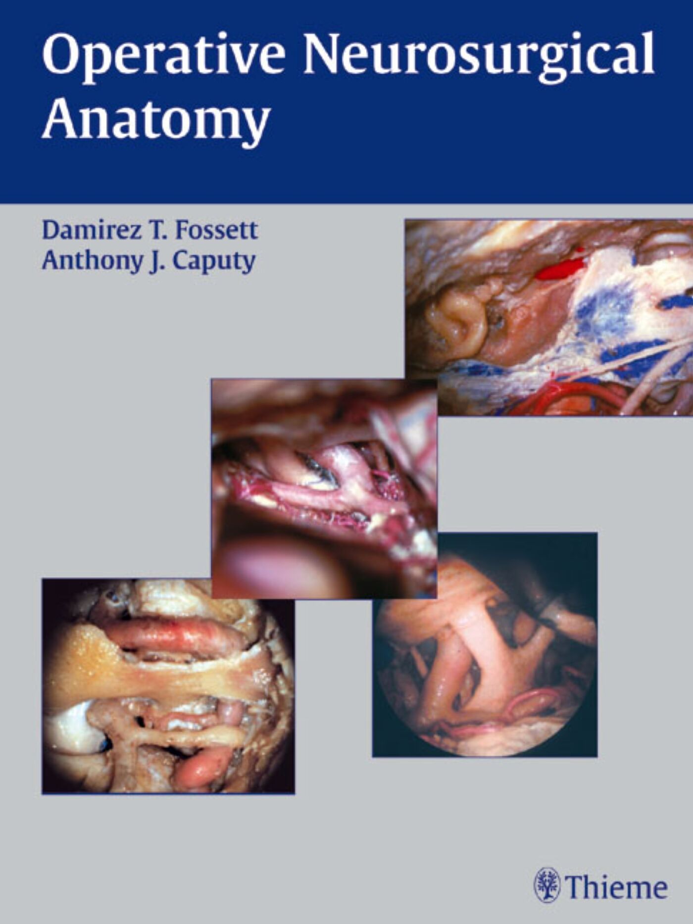 Operative Neurosurgical Anatomy: jetzt bestellen im Thieme Webshop | 9781626230293