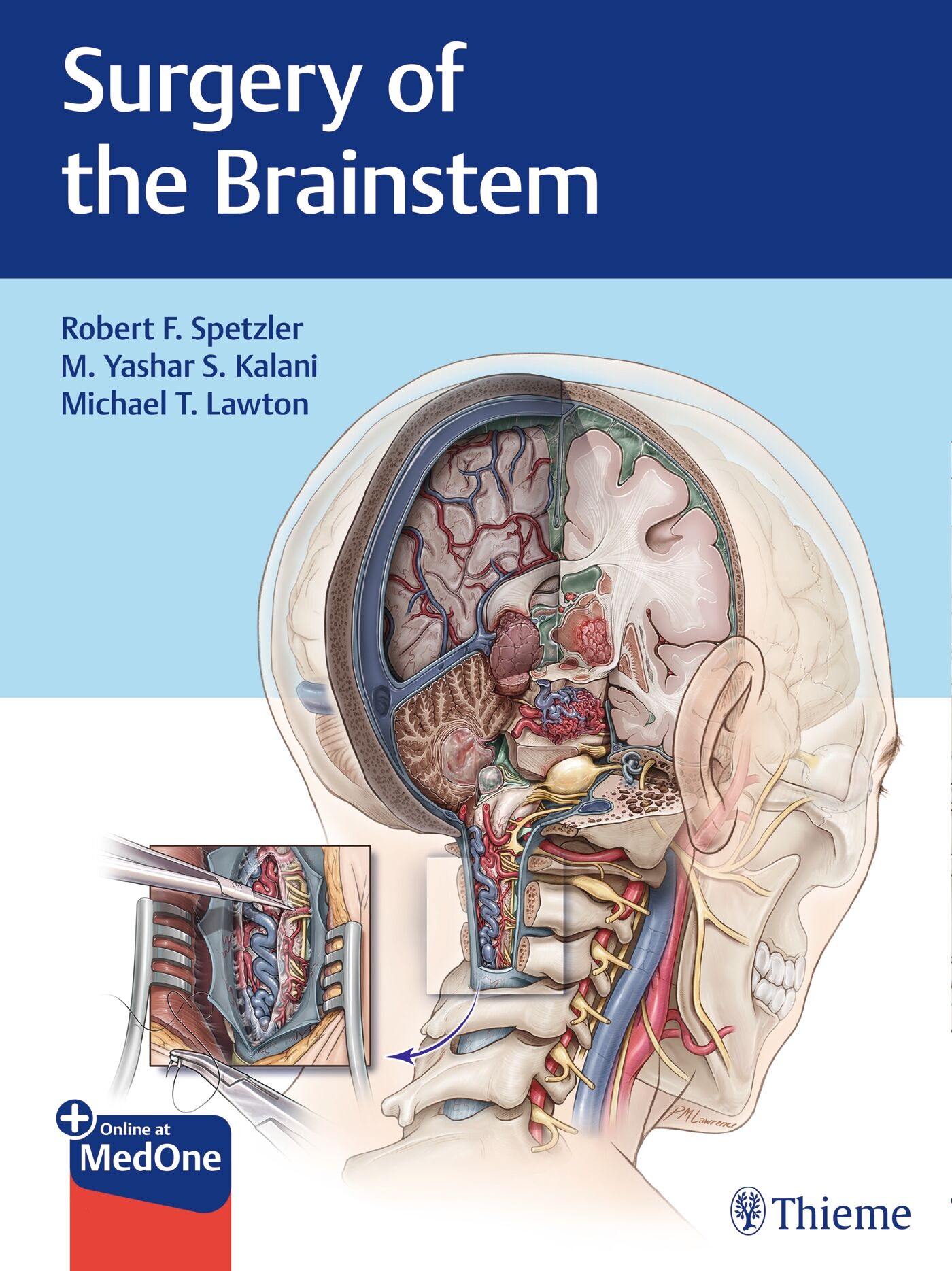 Surgery of the Brainstem | 9781626232921 | Thieme Webshop