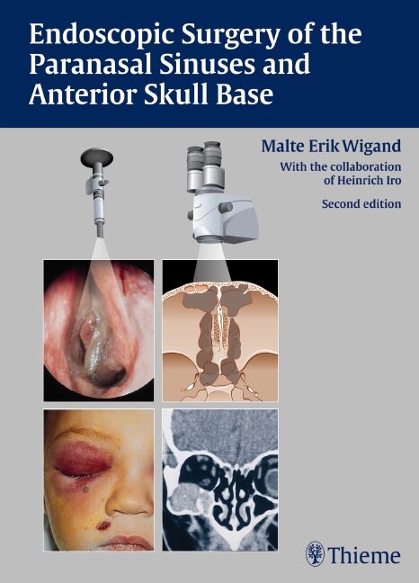 Endoscopic Surgery of the Paranasal Sinuses and Anterior Skull Base: jetzt bestellen im Thieme ...