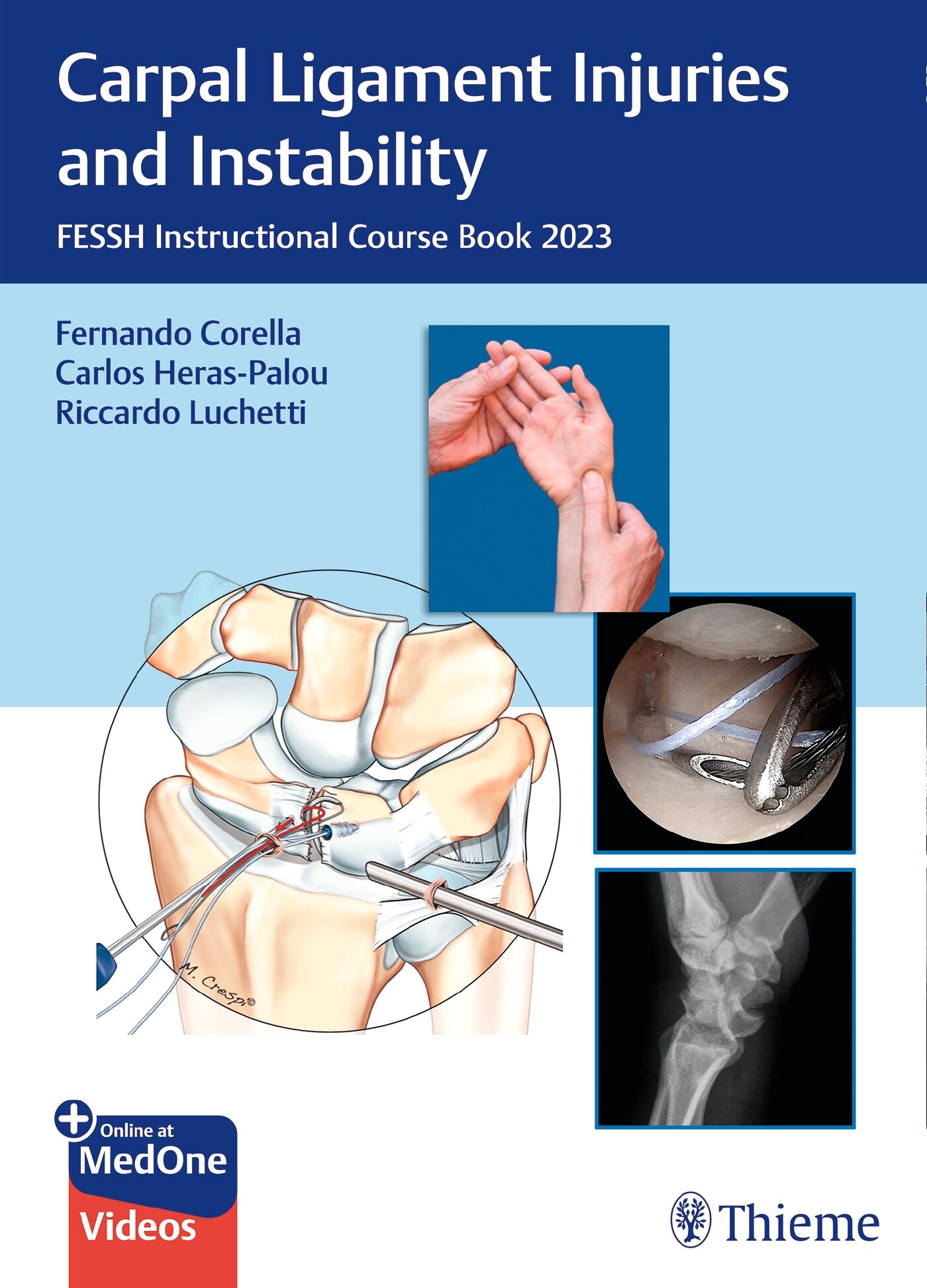 Carpal Ligament Injuries and Instability | 9783132451919 | Thieme Webshop
