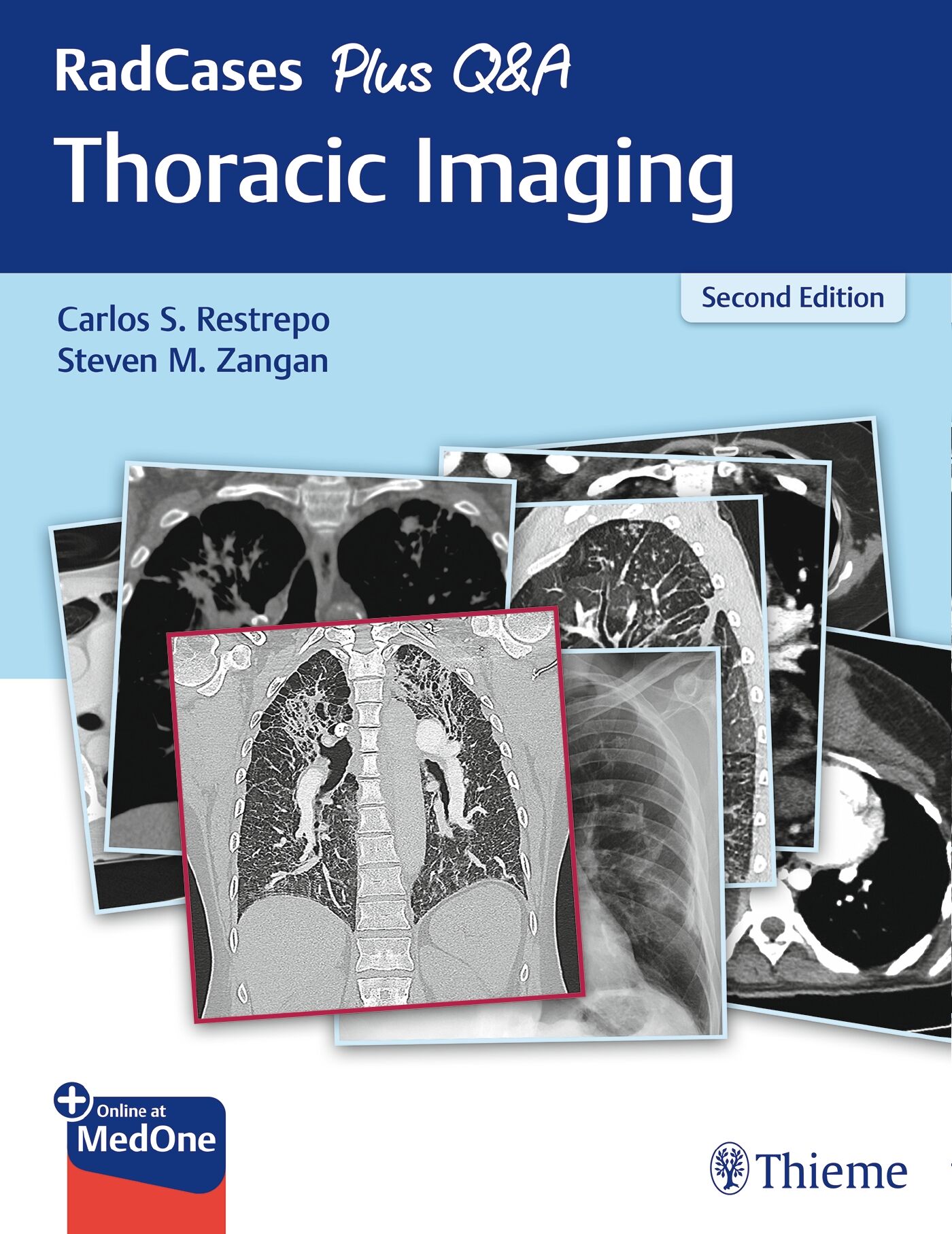 RadCases Plus Q&A Thoracic Imaging: jetzt bestellen im Thieme Webshop | 9781626238152