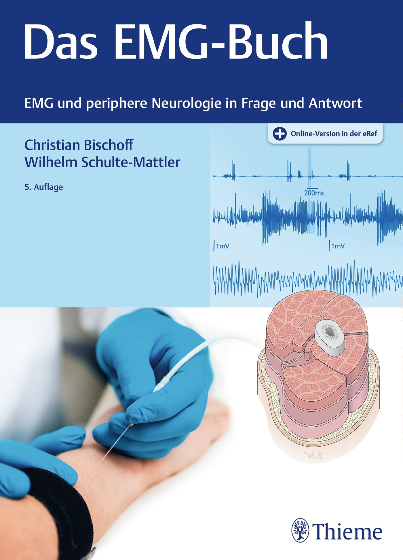 Das EMG-Buch: jetzt bestellen im Thieme Webshop | 9783132434394
