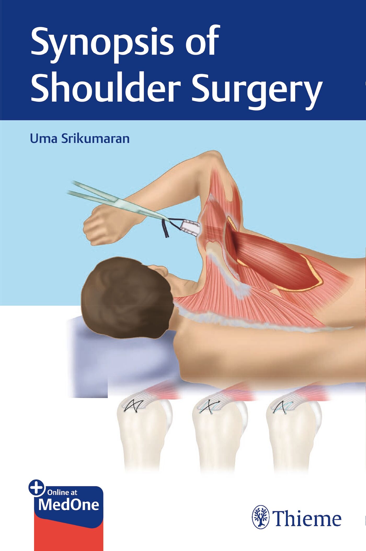 Synopsis of Shoulder Surgery | 9781638536529 | Thieme Webshop