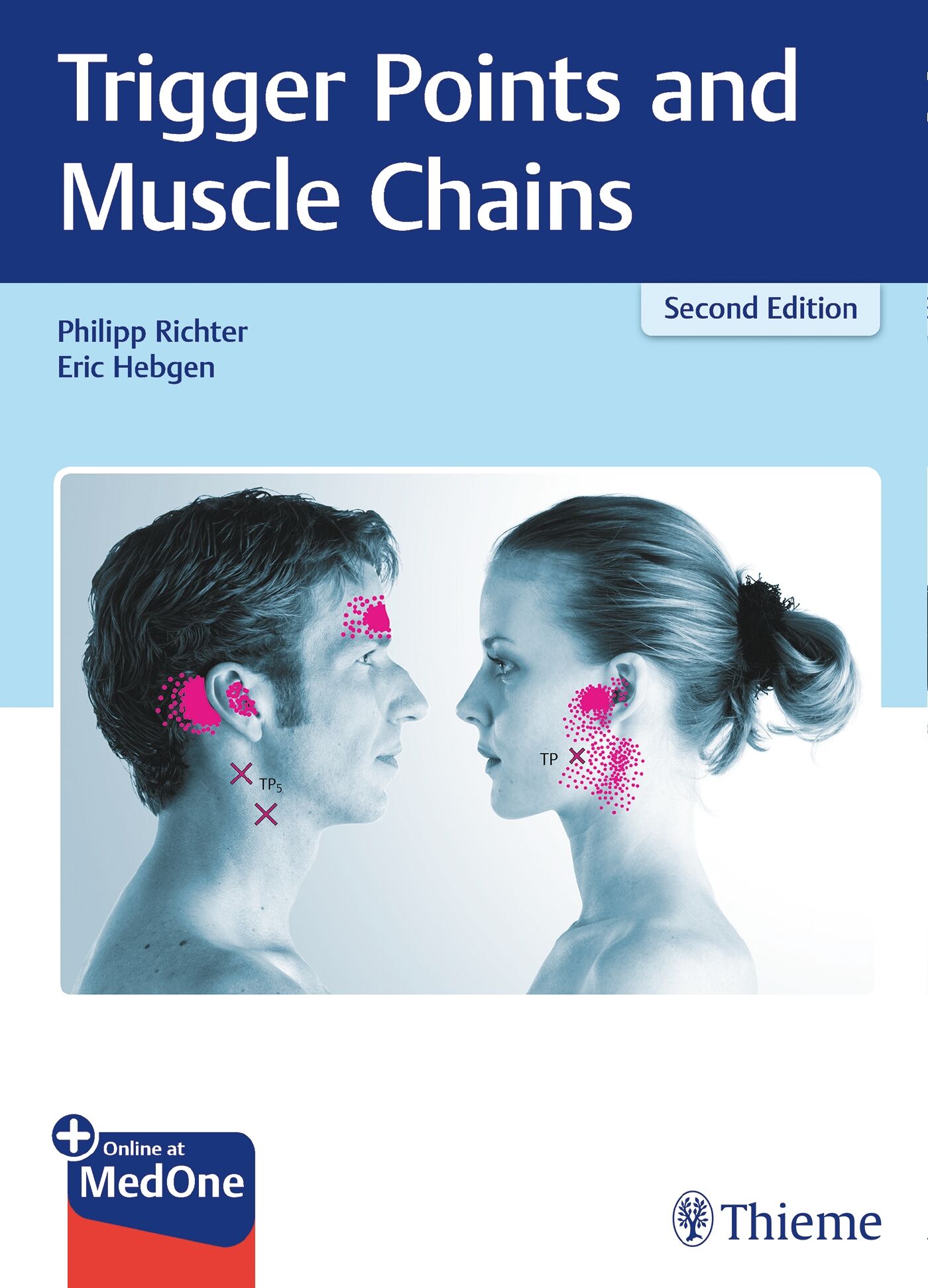 Trigger Points and Muscle Chains | 9783132413528 | Thieme Webshop