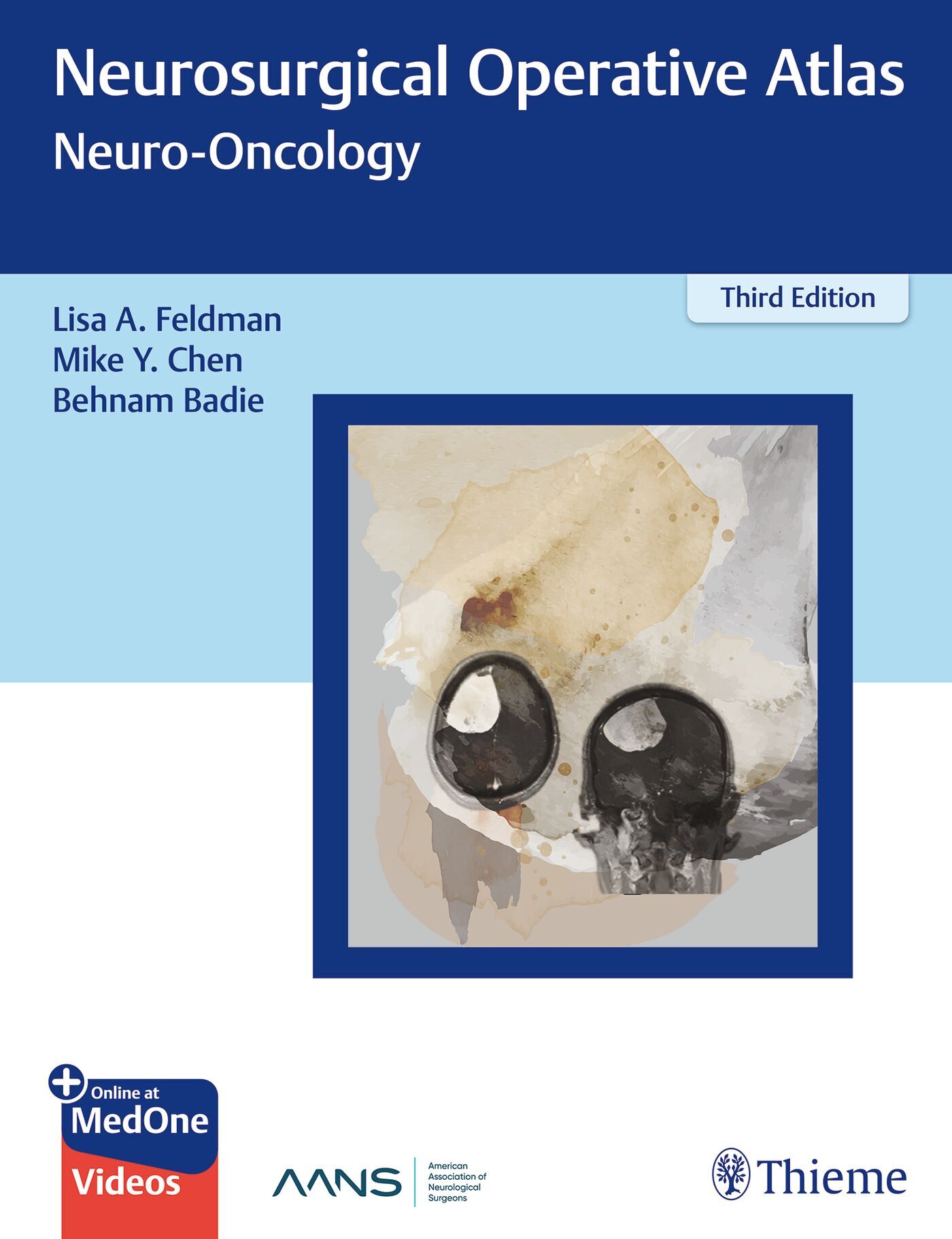 Neurosurgical Operative Atlas: Neuro-Oncology | 9781638531142 | Thieme ...