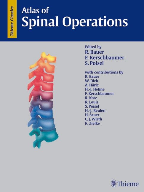 Atlas of Spinal Operations: jetzt bestellen im Thieme Webshop ...