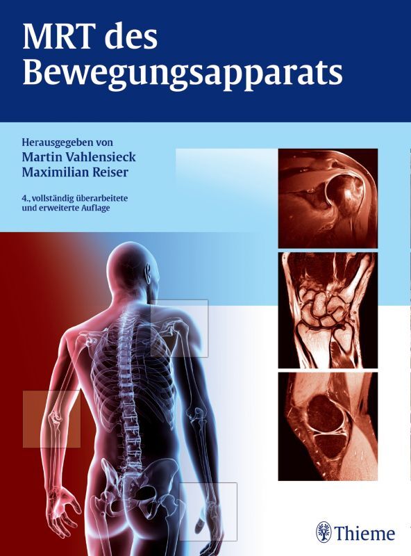 MRT des Bewegungsapparats | 9783131637246 | Thieme Webshop MRT des Bewegungsapparats | 9783131637246 | Thieme Webshop