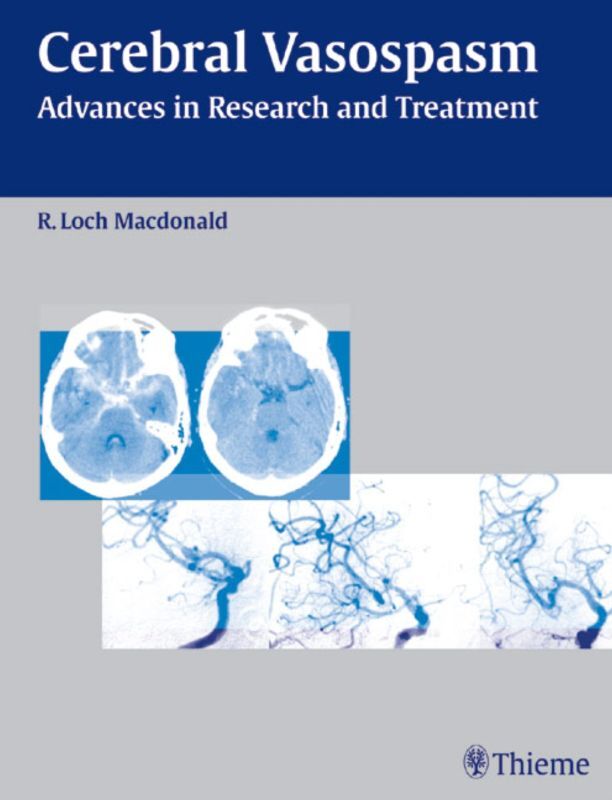 Cerebral Vasospasm: jetzt bestellen im Thieme Webshop | 9781588902832